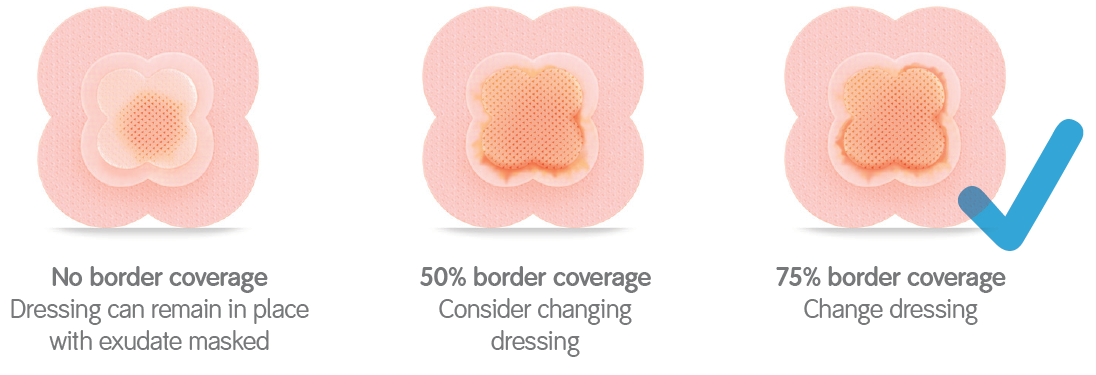 ALLEVYN Life Foam Dressings